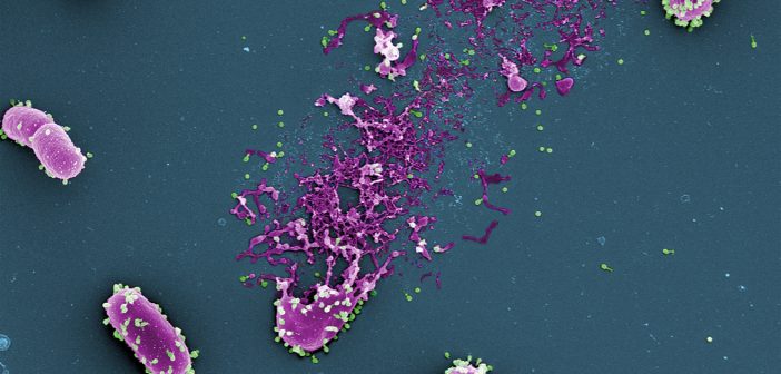 Using Viruses to Treat Bacterial Infections – Ahmad Tarmizi Abdul Halim ...